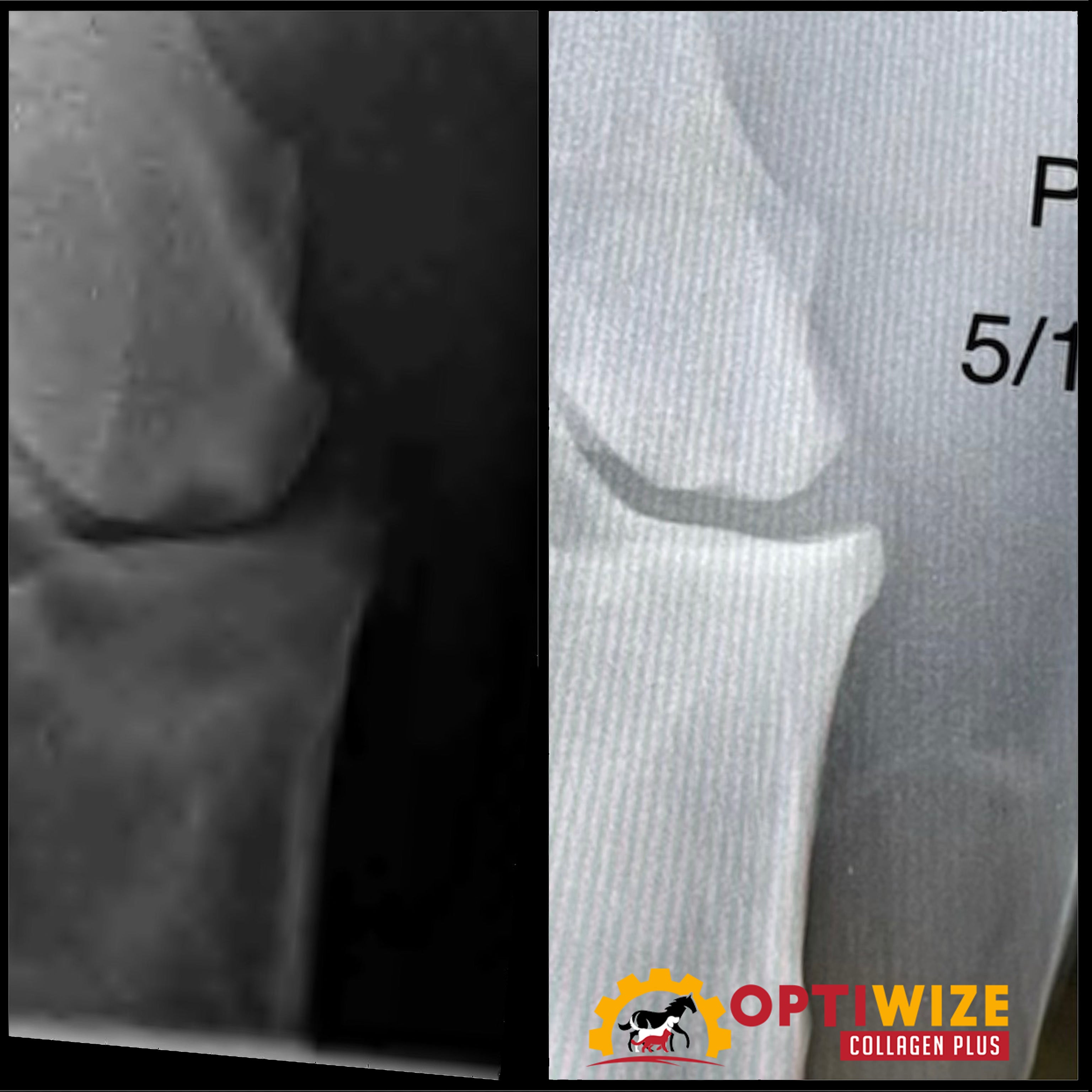 X-RAYS & Ultrasounds – OptiWize